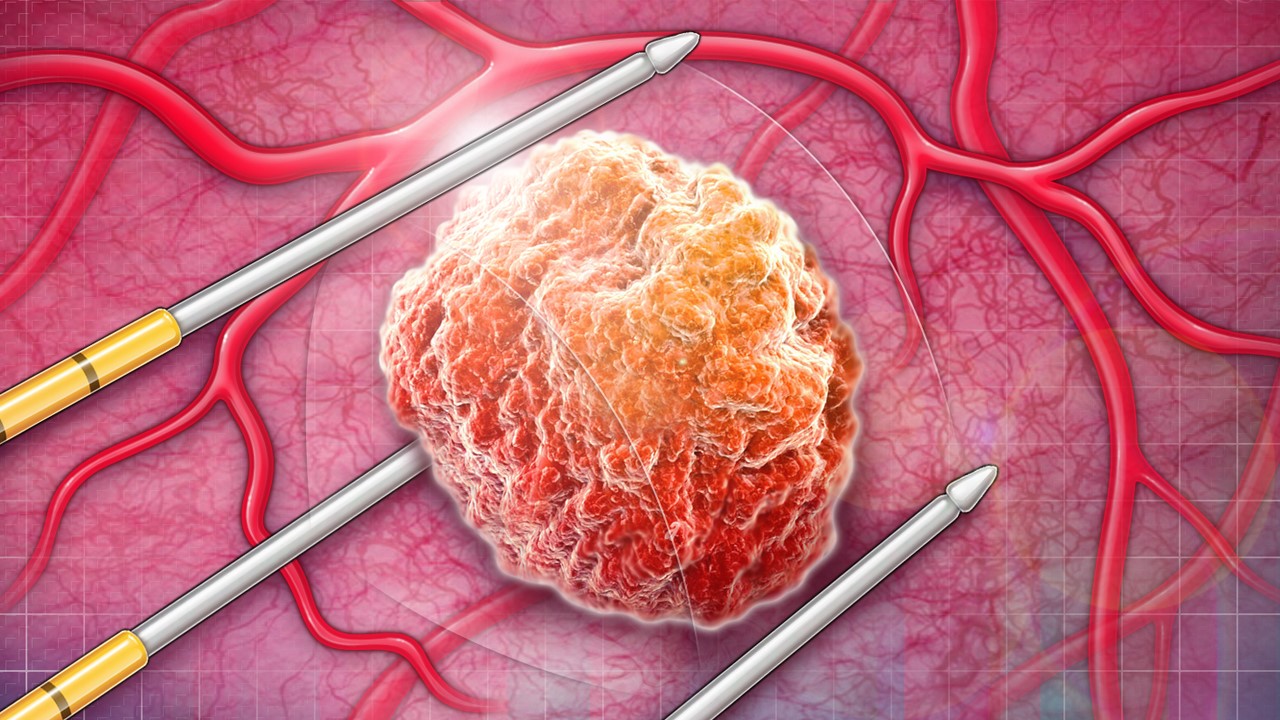 IRE Training and Mentoring in NSW - Dr Phillip Stricker